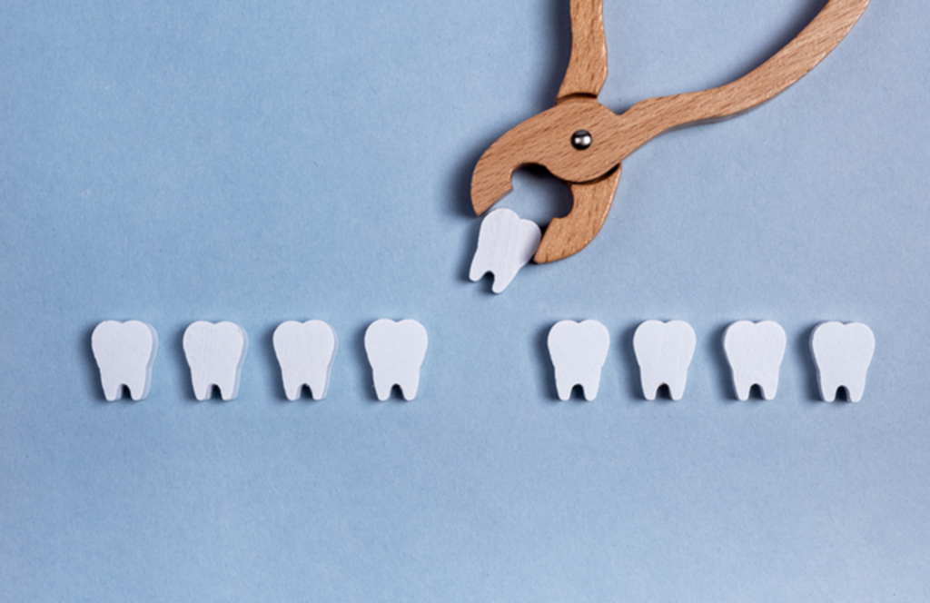 What are Tips for Faster Recovery After a Tooth Extraction?